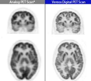 Digital PET/CT - Peninsula Imaging
